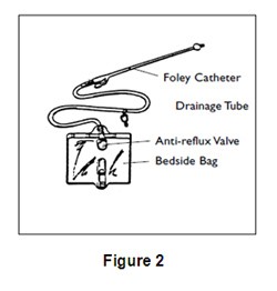 Indwelling catheter: Care instructions