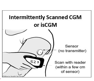 Continuous Glucose Monitoring