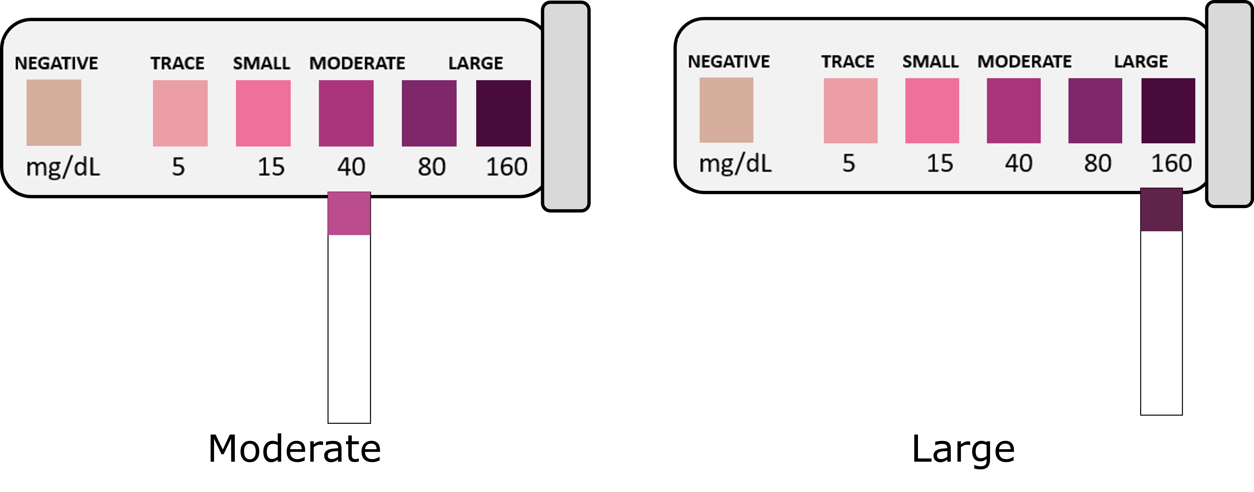 Preventing diabetic ketoacidosis (DKA) in insulin pump therapy: Care ...